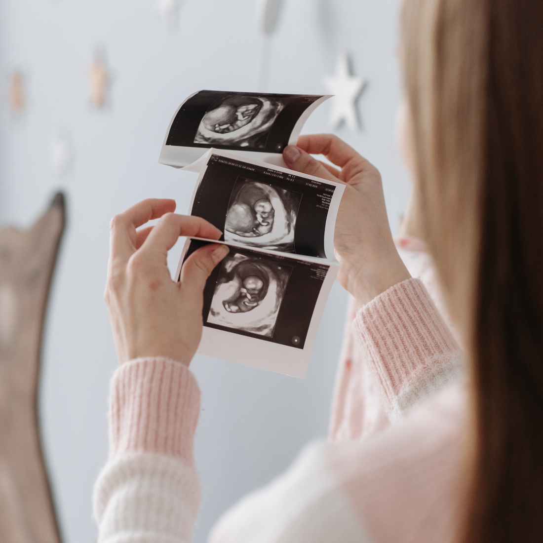 Exploring the Magic of Ultrasound: From 2D to 5D – Bloom Baby Ultrasound